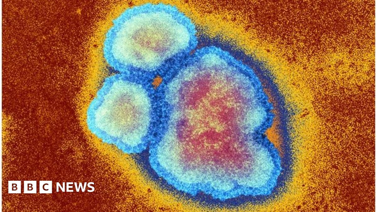 Measles: 43 new cases in south west Wales outbreak - BBC News