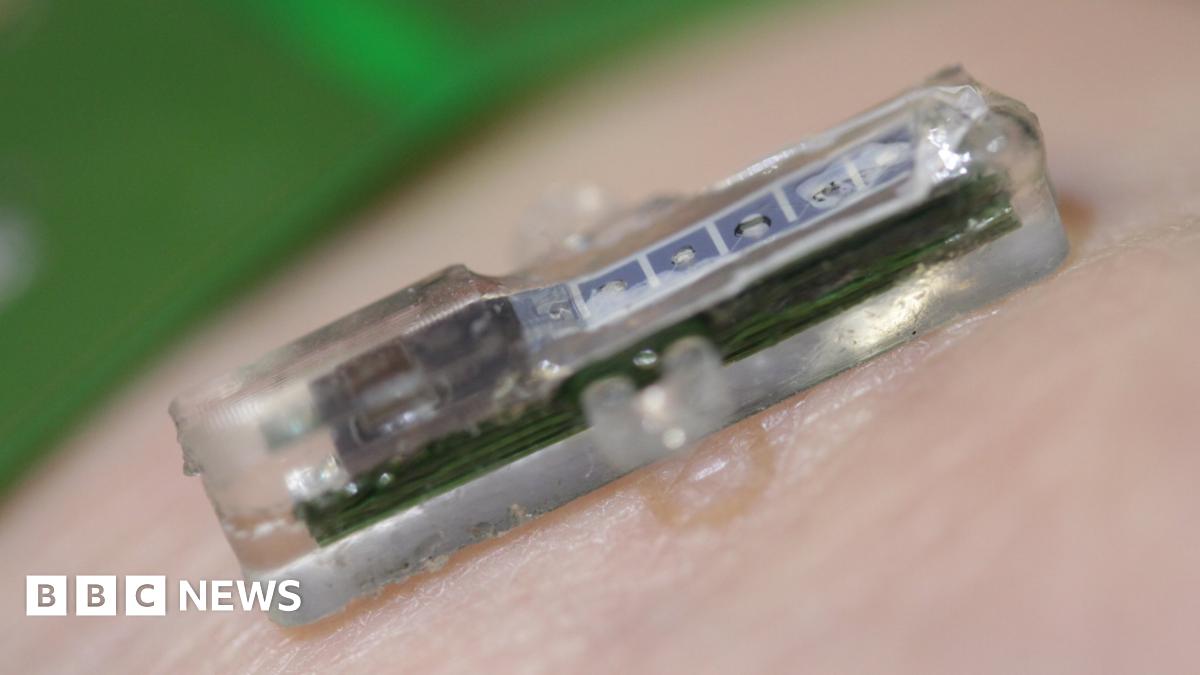 'Under the skin' blood-testing device developed - BBC News
