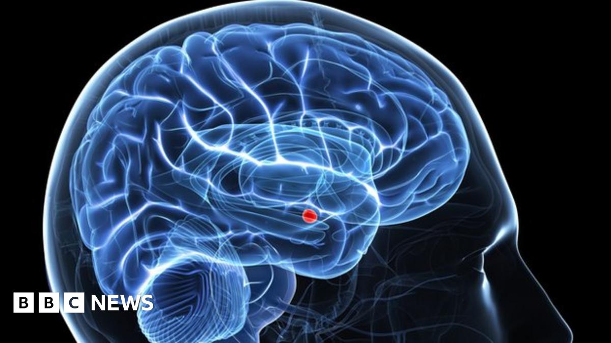 Autism is largely down to genes, twins study suggests - BBC News