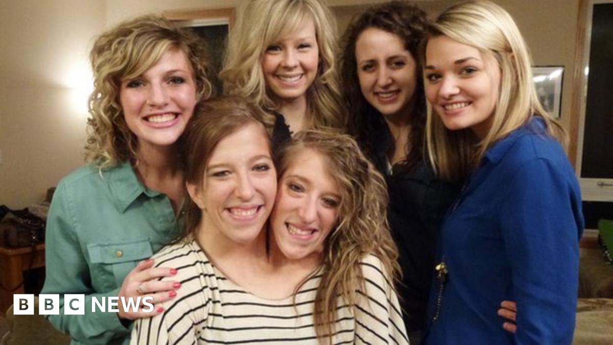 Living a conjoined life - BBC News