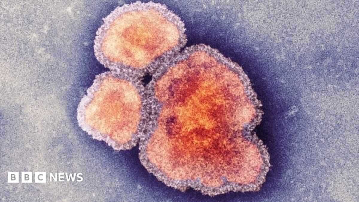 Measles outbreak in maps and graphics - BBC News