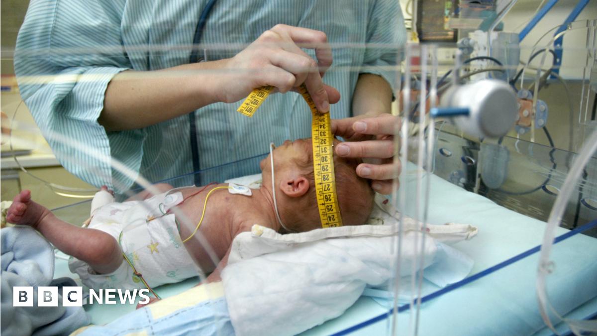 Scans show premature-baby brain arrested development - BBC News