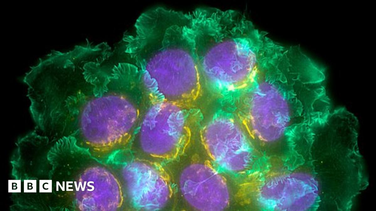 Curing cancer or 'selling hope' to the vulnerable? - BBC News