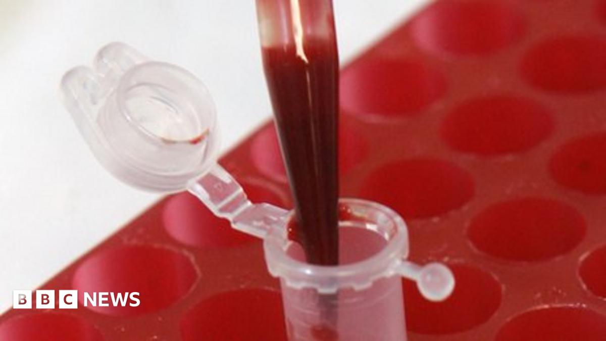 Early Down's test 'more sensitive' - BBC News
