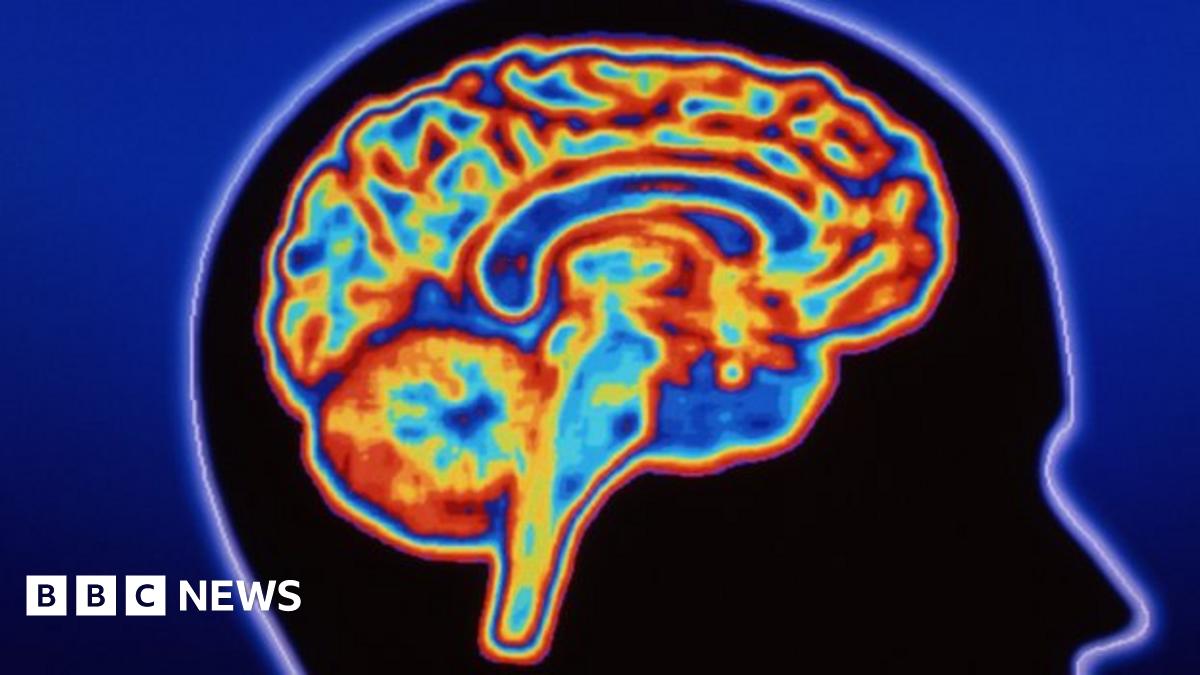 How the brain controls a 'mind machine' - BBC News
