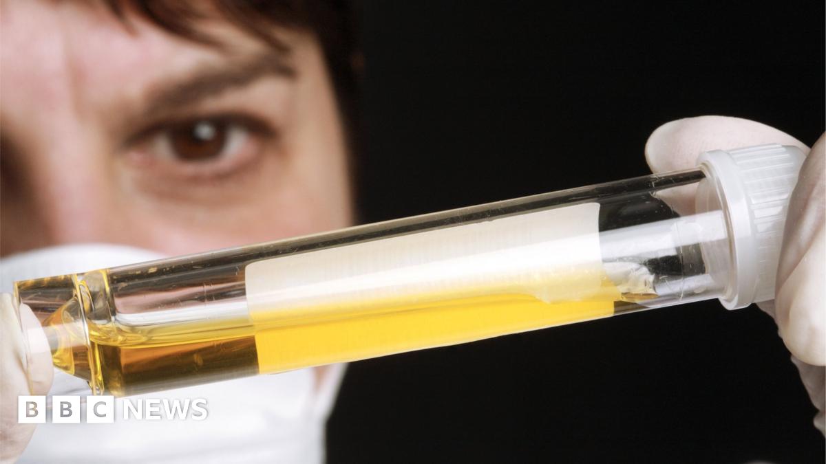 Urine odour test for bladder cancer - BBC News