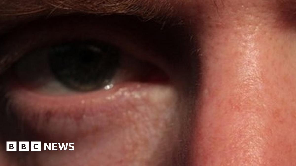 Stalking advocacy group for victims launches - BBC News