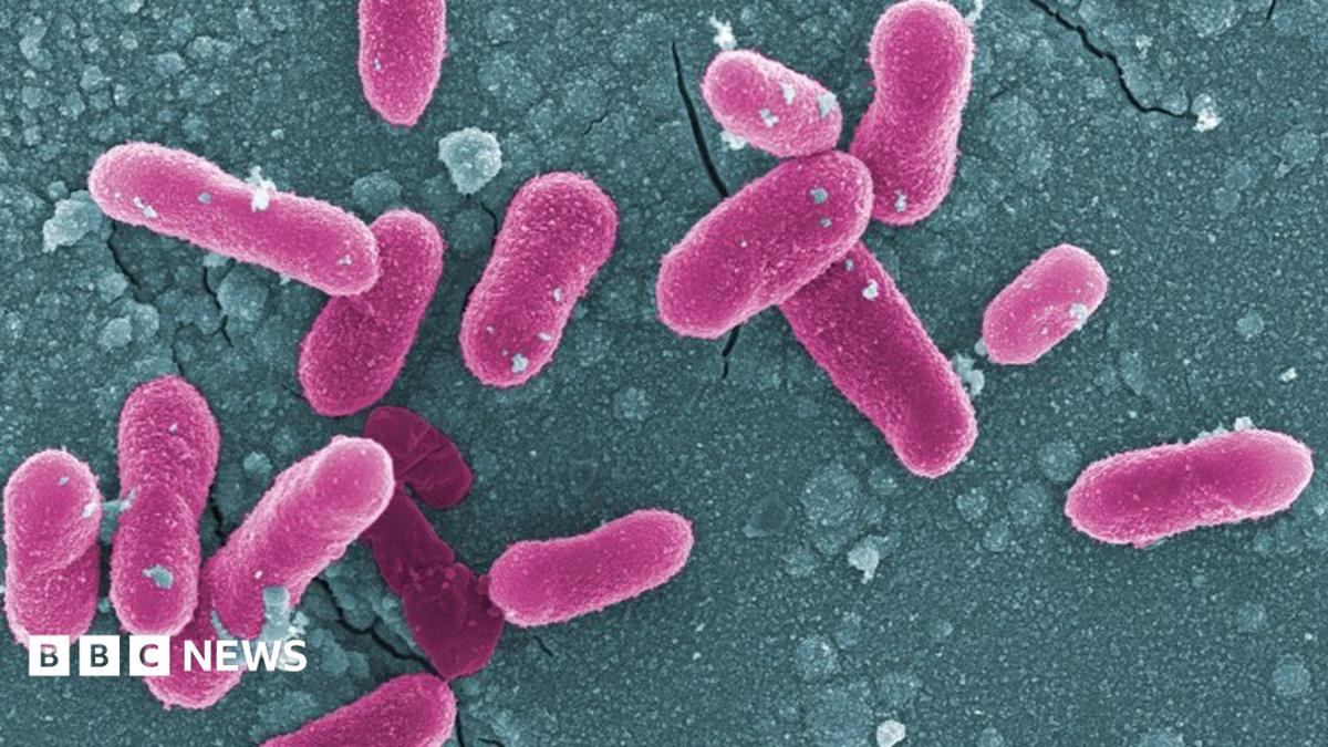 Jersey business shuts after salmonella bug - BBC News