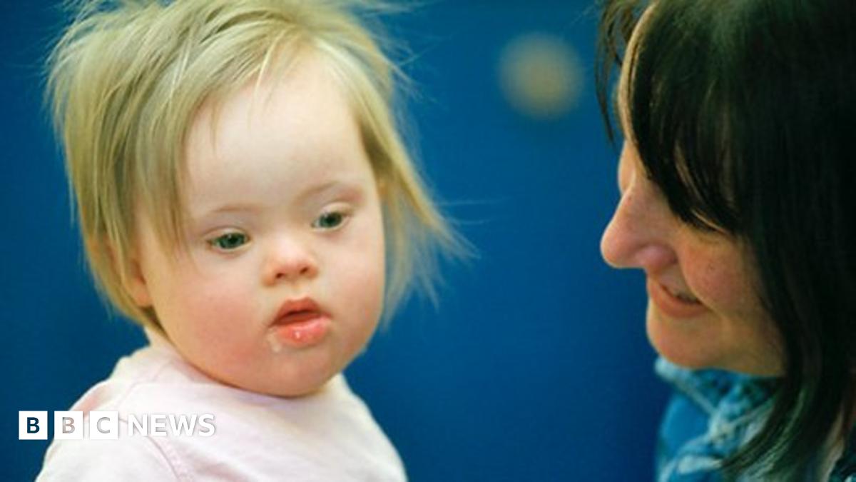 Genetic advance in Down's syndrome - BBC News