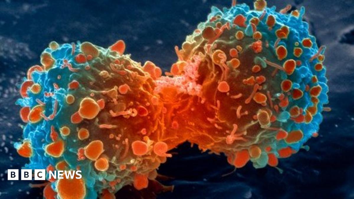 Immune system boost 'fights cancer' - BBC News