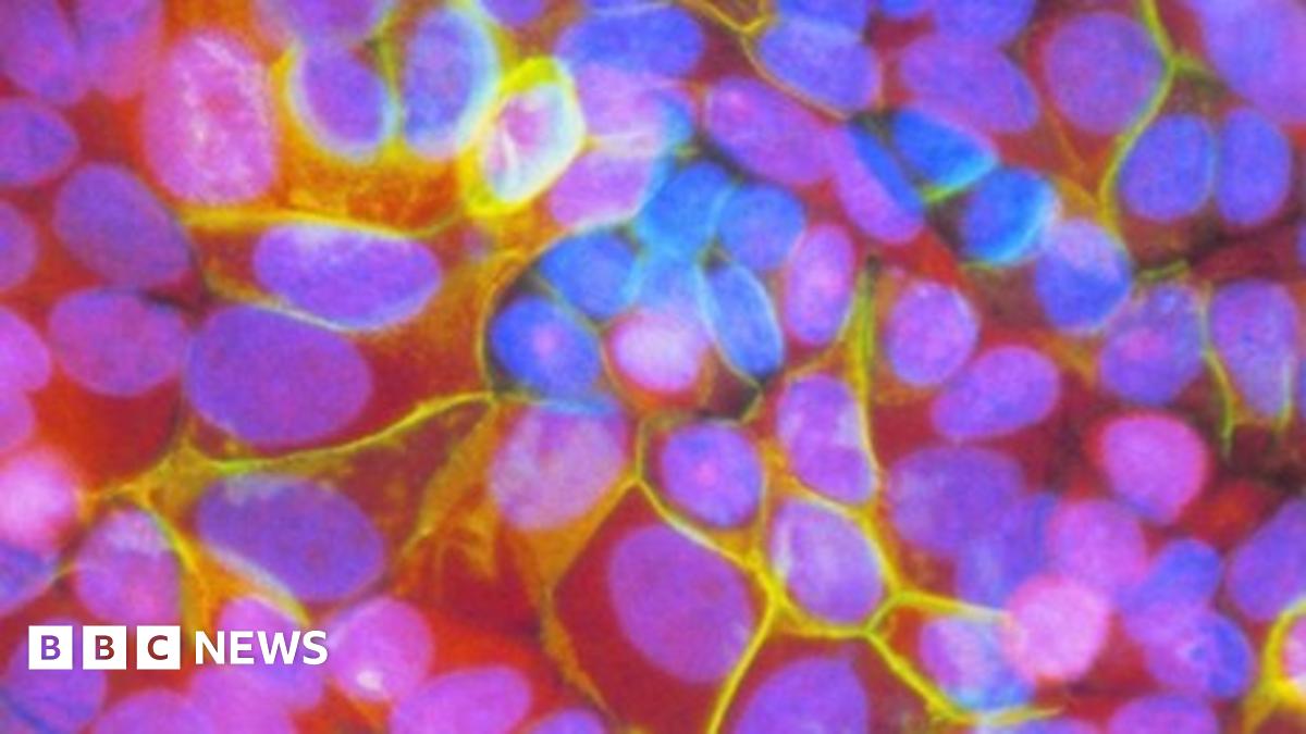 Mobile phone game 'could find cancer cures' - BBC News