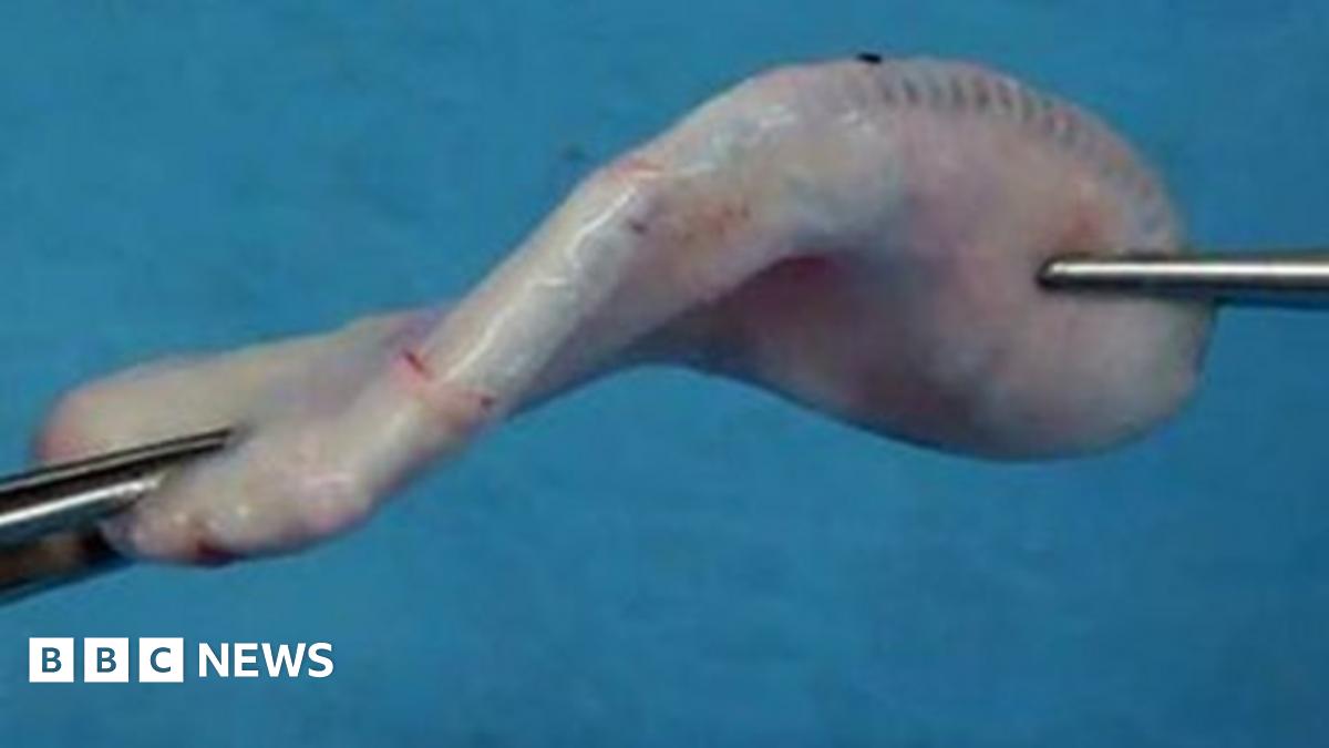 Artificial human ear grown in lab - BBC News