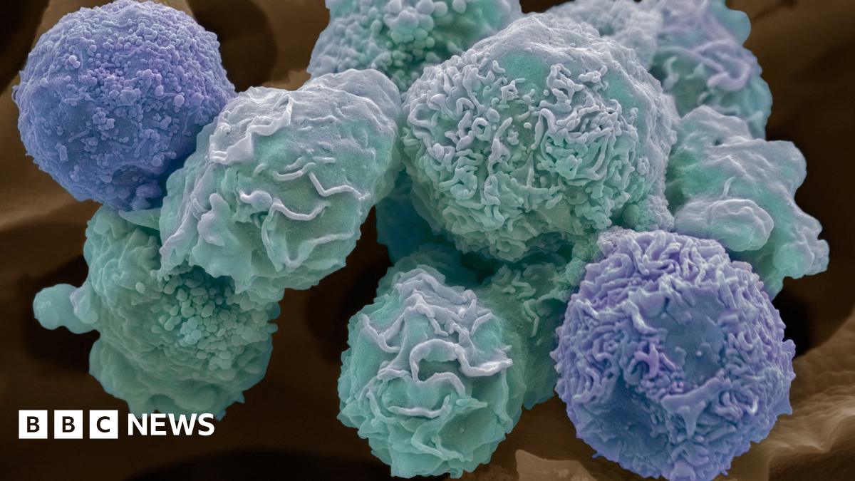 Milestone study probes cancer origin - BBC News