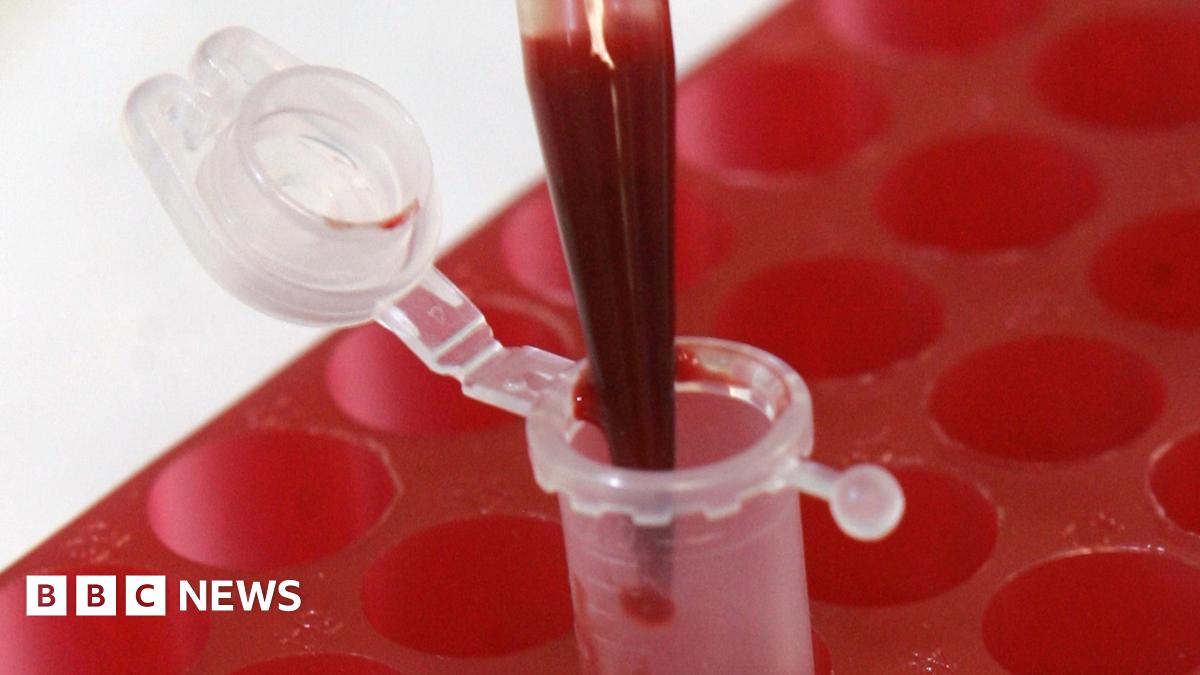 Republic of Ireland babies at risk of wrong blood group - BBC News