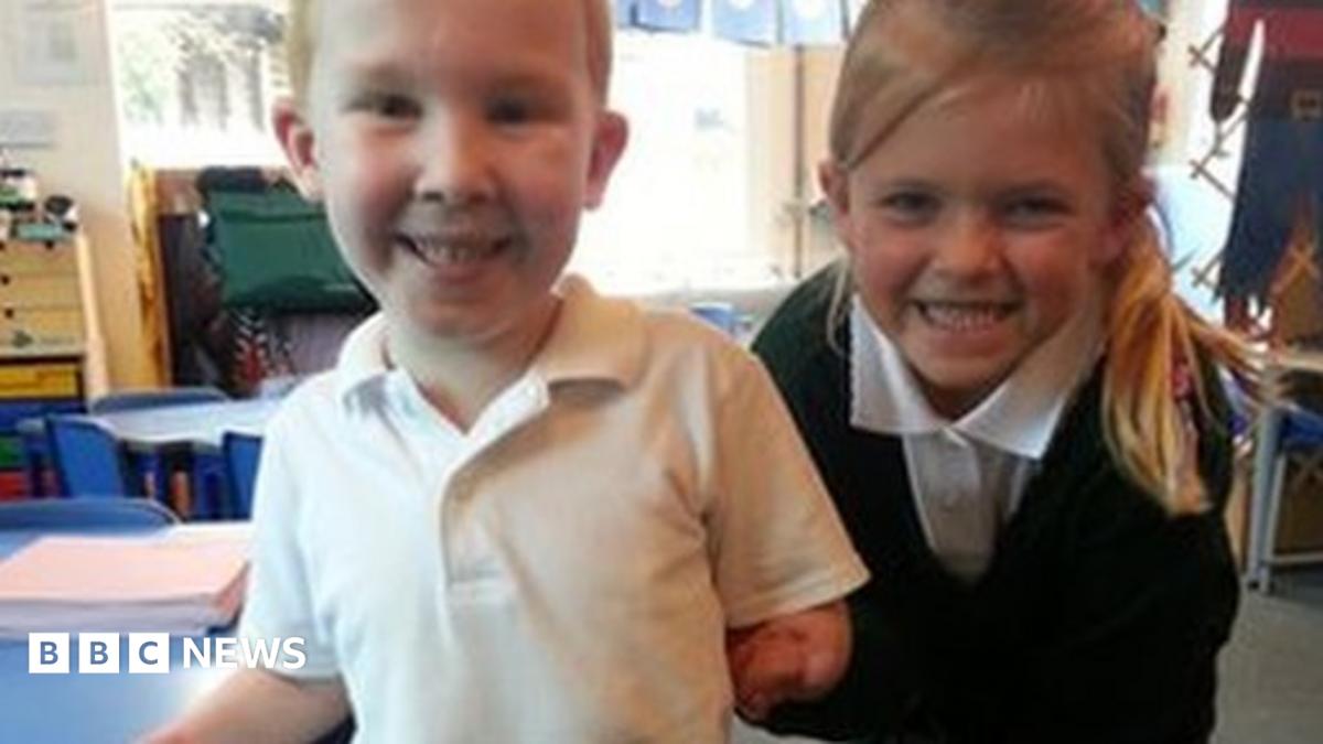 Meningitis boy Marshall Janson tries out prosthetic blades - BBC News
