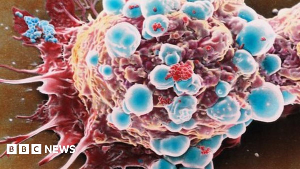 Seven classes of breast cancer test 'offers new hope' - BBC News