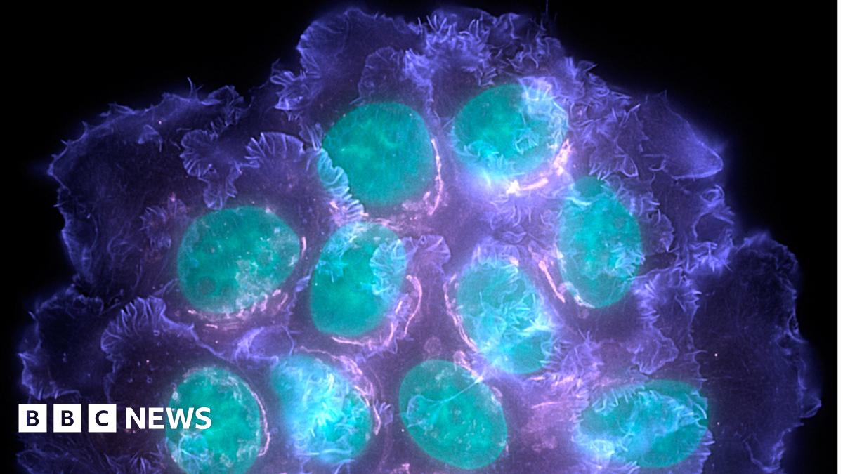 Cancer diversity has 'huge implications' - BBC News