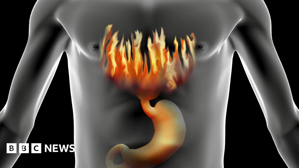 Ulcer drugs linked to vitamin B12 deficiency - BBC News