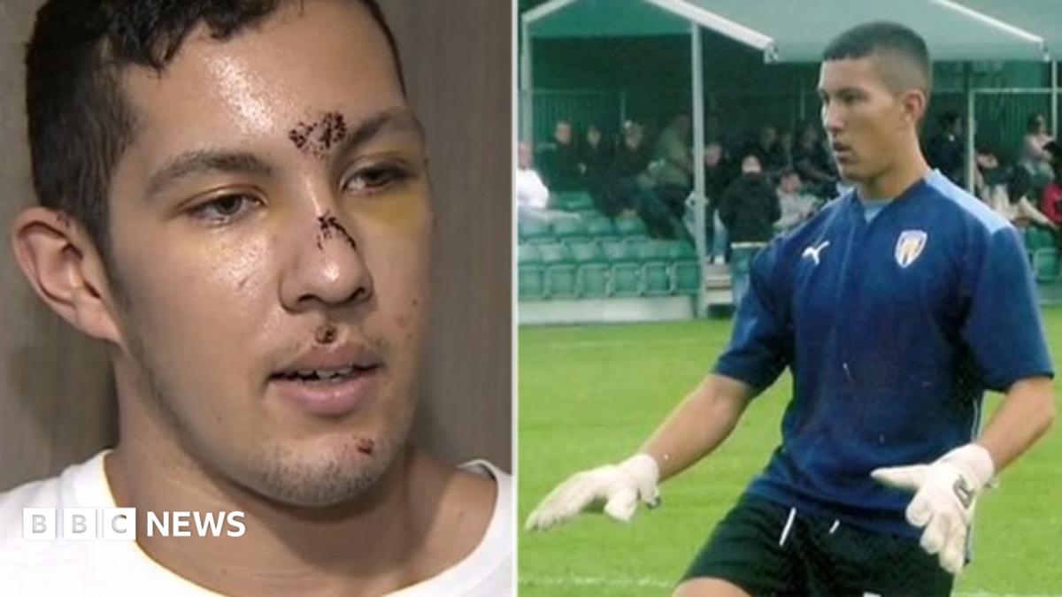 Wivenhoe Town goalkeeper attack: Surgery for Richie Robins - BBC News