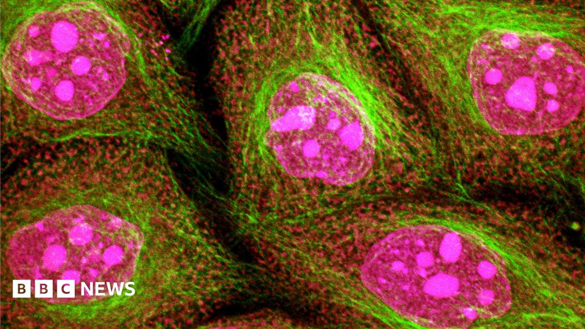 'Heat maps' find cervical cancer - BBC News