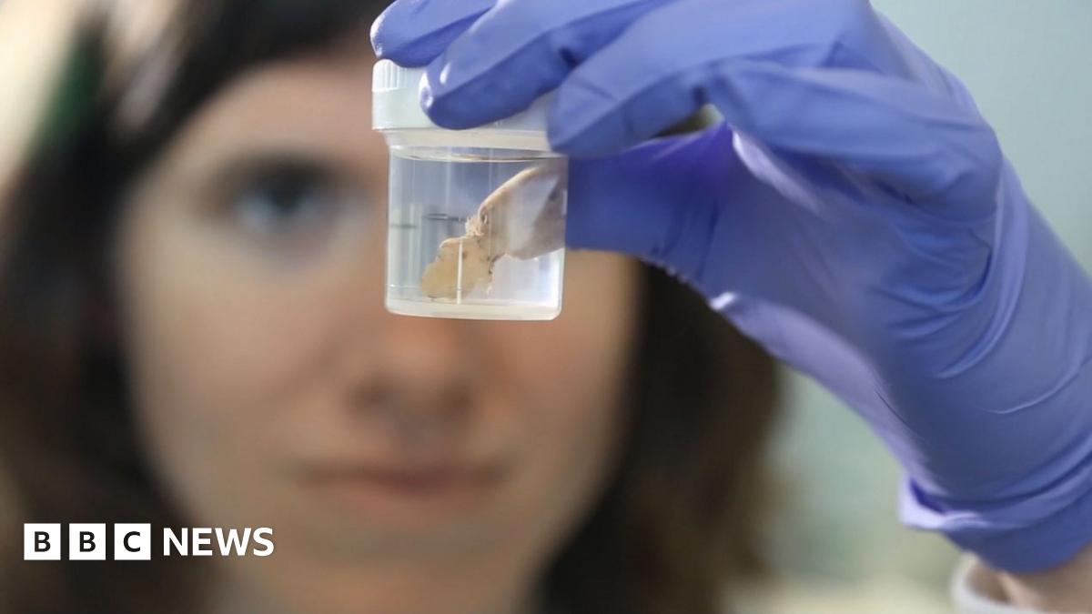 World's oldest-known living cancer '11,000 years old' - BBC News