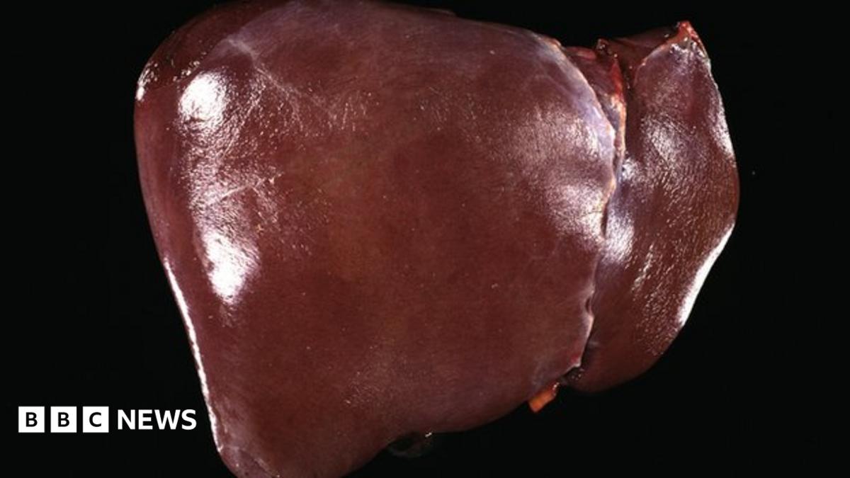 ‘Scandal’ of liver disease inaction - BBC News