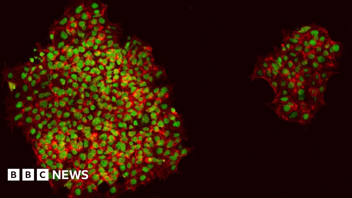 Human skin grown in lab 'can replace animal testing' - BBC News