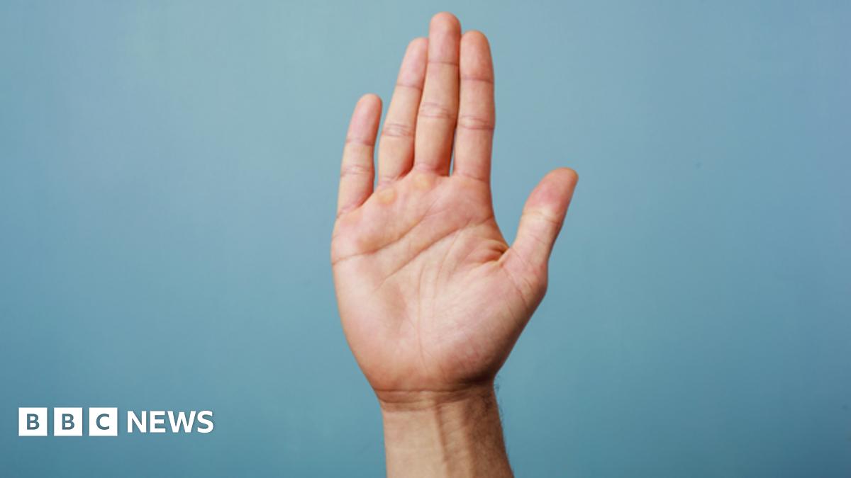 Full disclosure: When should you reveal a disability at work? - BBC News