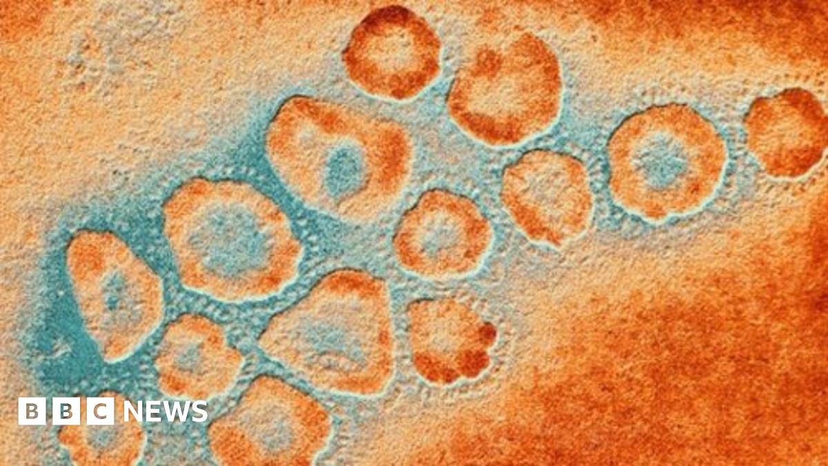 Mers: The mystery virus with no known cure - BBC News