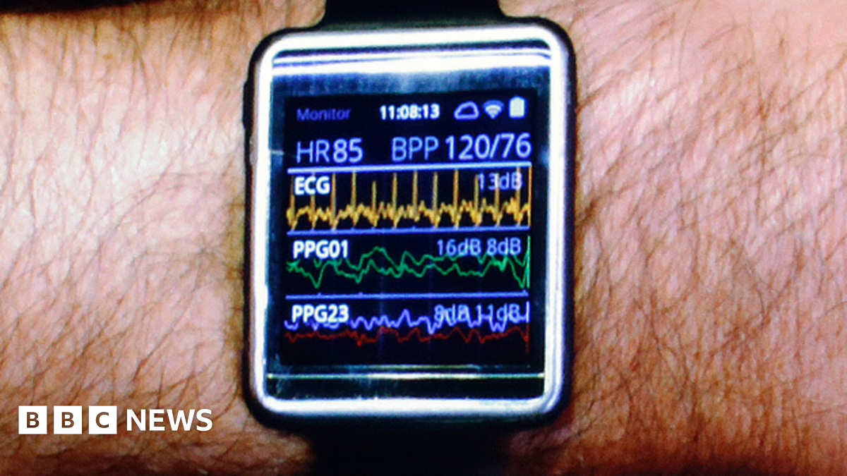 Samsung reveals Simband and Sami health platform - BBC News