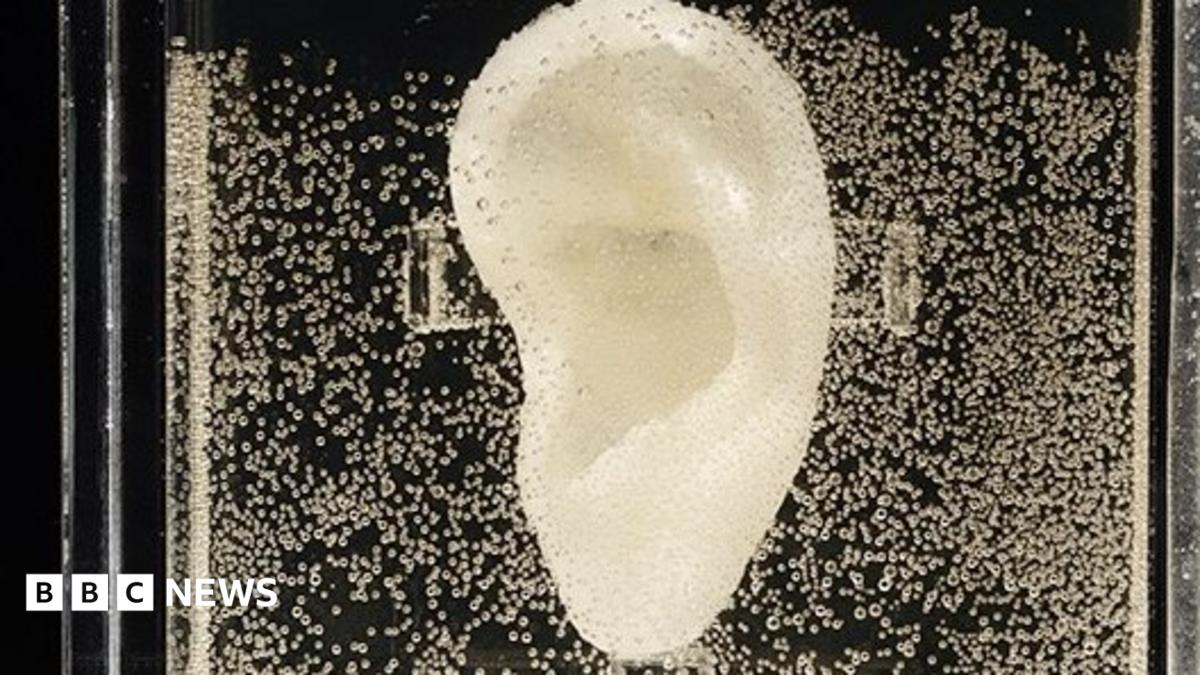 Vincent van Gogh 'live ear' on display - BBC News