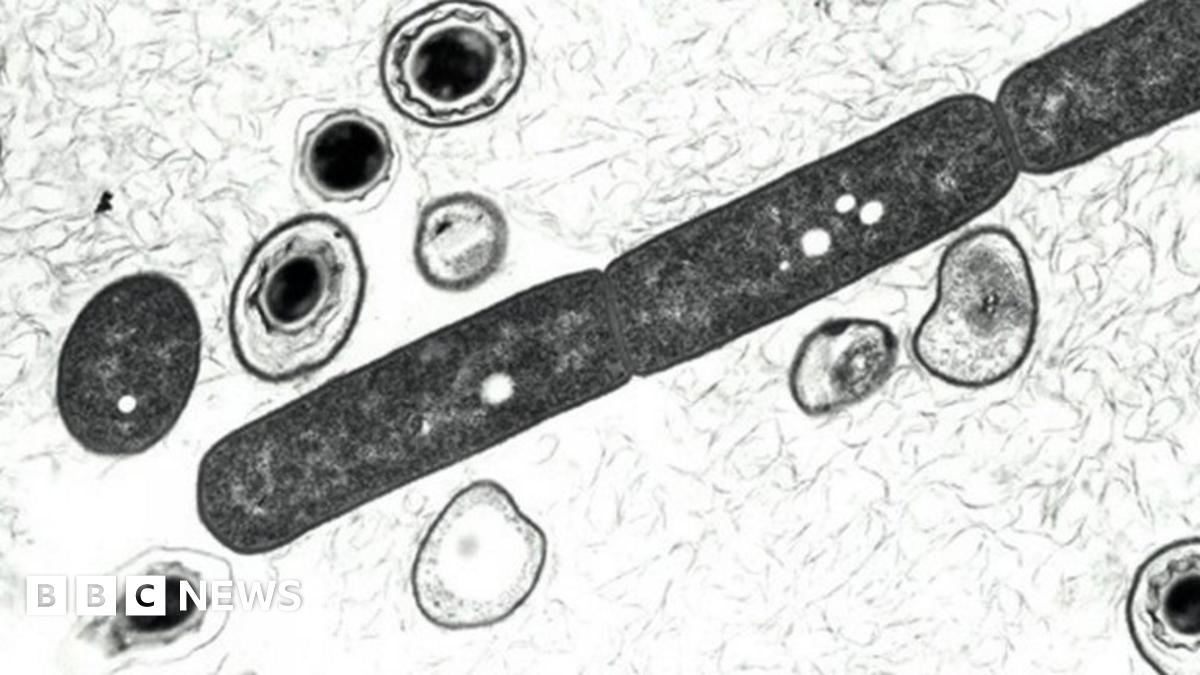 CDC: Possible US anthrax cases rise to 84 - BBC News