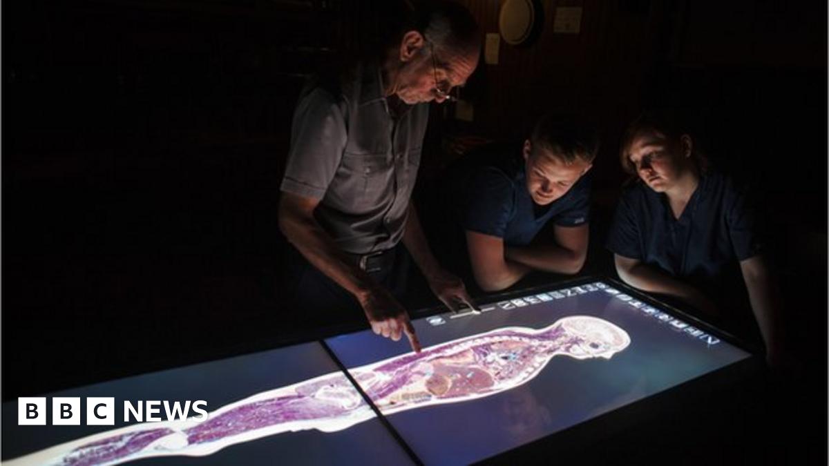 Anatomy students work on life-size virtual cadaver at University of ...