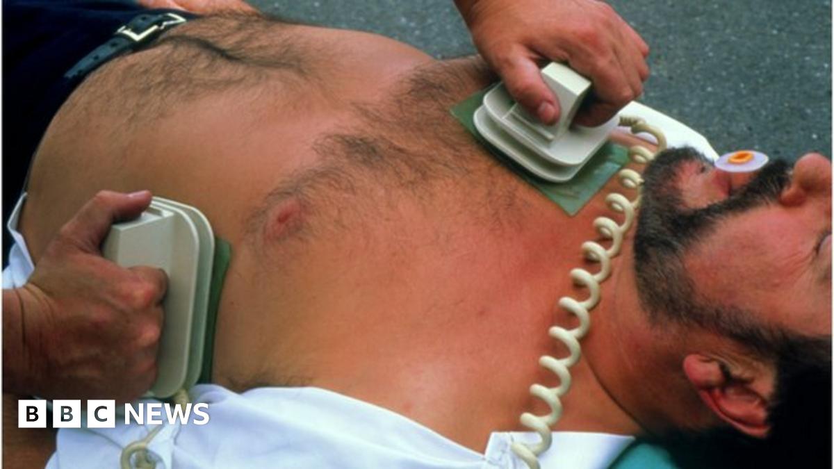'Resuscitation drug adrenaline questioned in cardiac arrest' - BBC News