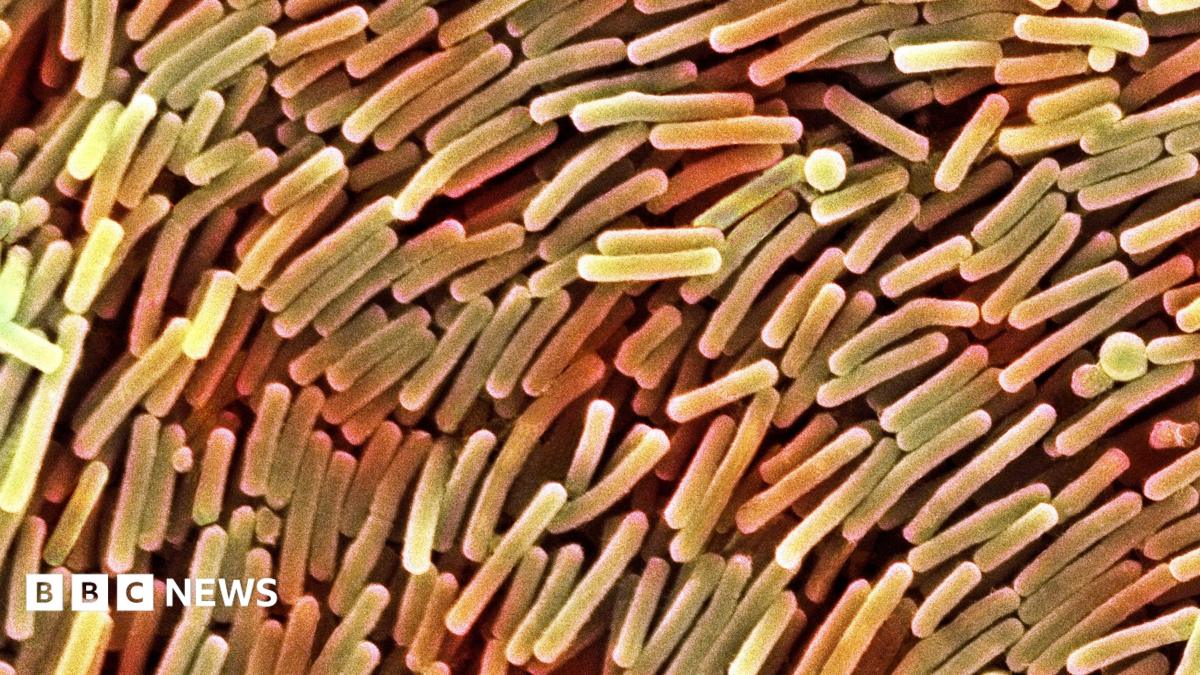 Gut bugs 'help prevent allergies' - BBC News