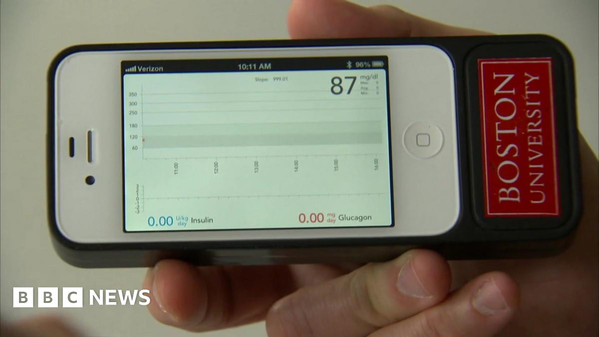 Bionic pancreas: A new dawn for diabetics? - BBC News
