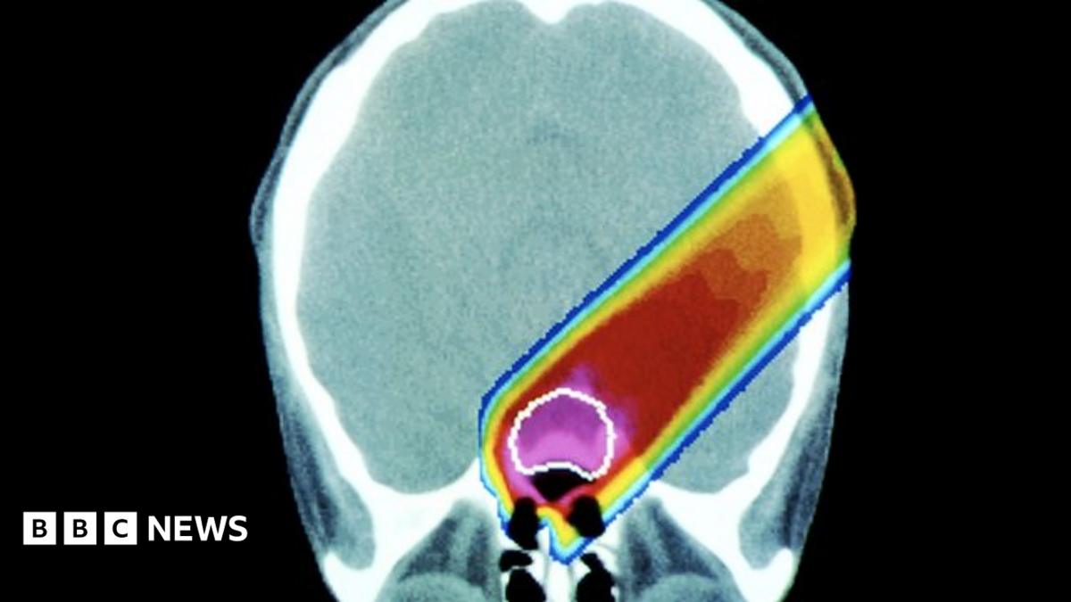 First proton beam cancer treatment unit to open in Cardiff - BBC News