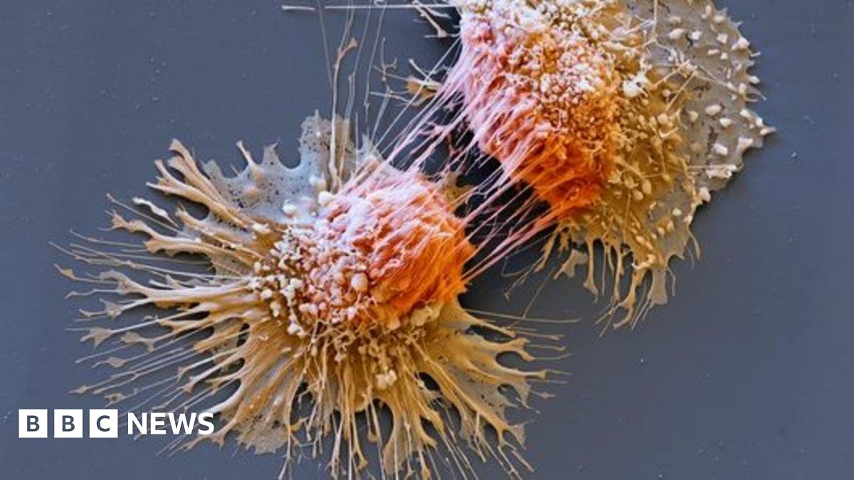 Cancer gene test 'would save lives' - BBC News