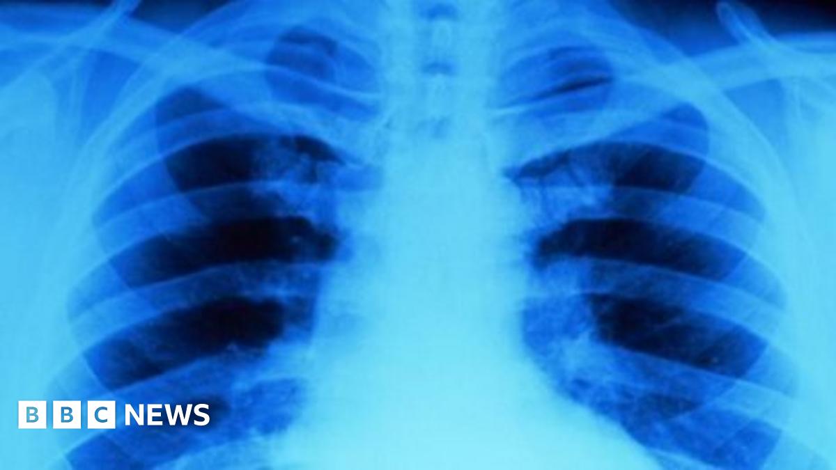 Asbestos victims win damages ruling - BBC News