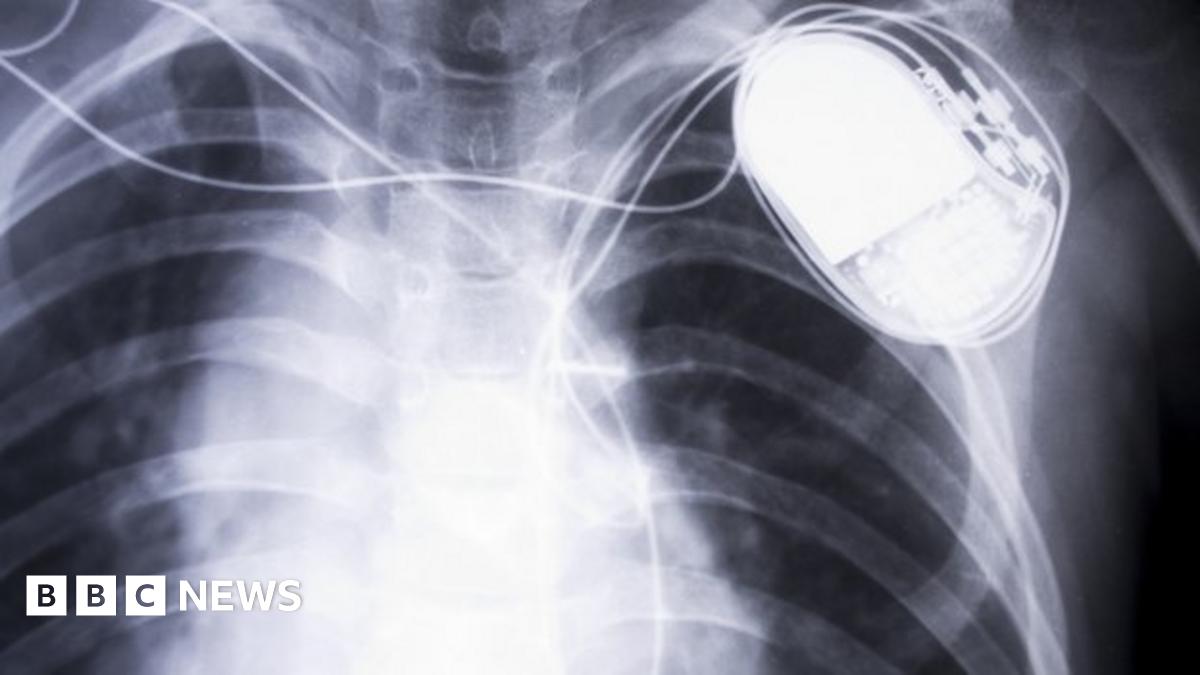 US 'probes hackable flaws' in medical devices - BBC News