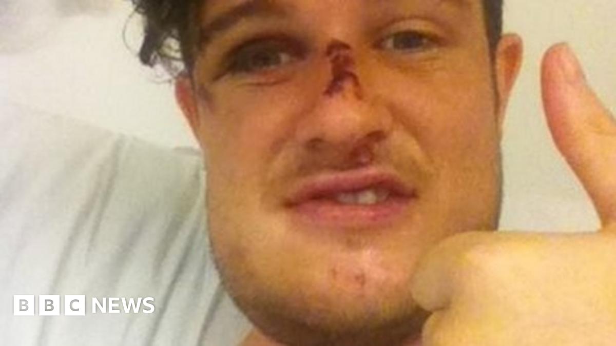 Aberystwyth Town footballer Luke Sherbon attacked - BBC News