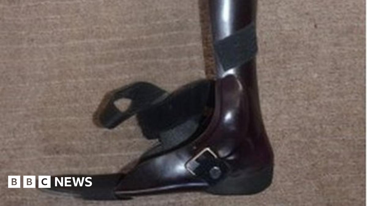 Leg splints stolen from Skegby cerebral palsy teenager - BBC News