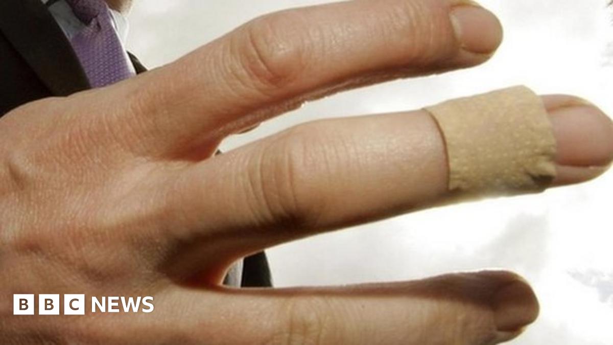 NHS only offers a 'sticking plaster' for inequality in Scotland - BBC News