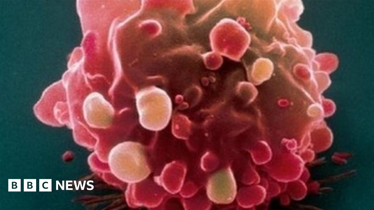 Scottish cancer cases reach 'record high' - BBC News