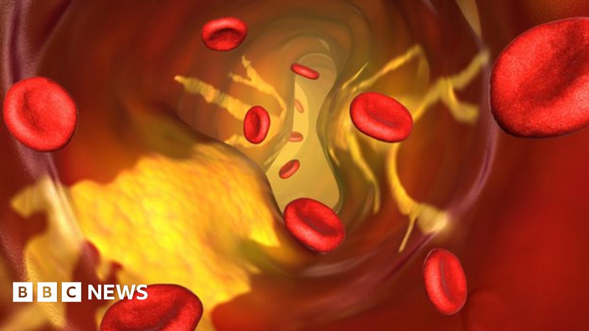 Slightly high cholesterol in mid-life 'risky for heart' - BBC News