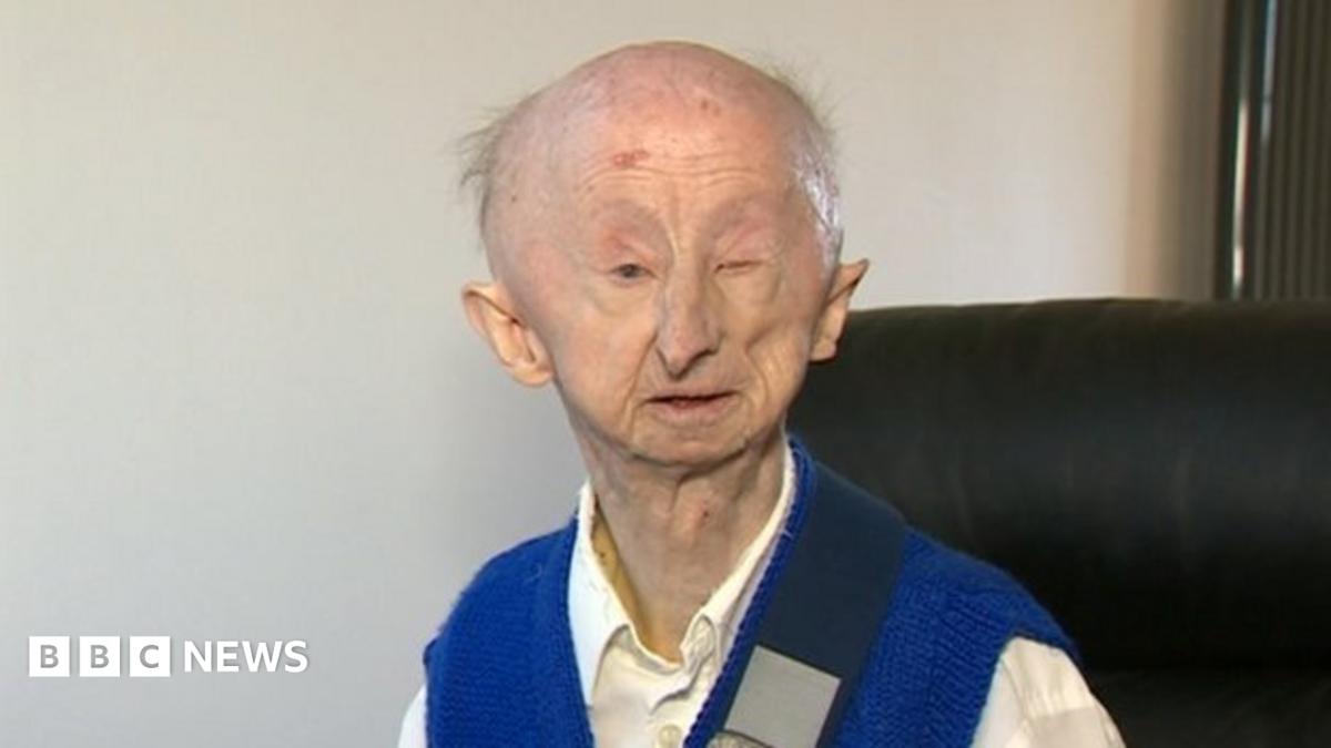 Alan Barnes fund: Donations halted for mugging victim - BBC News