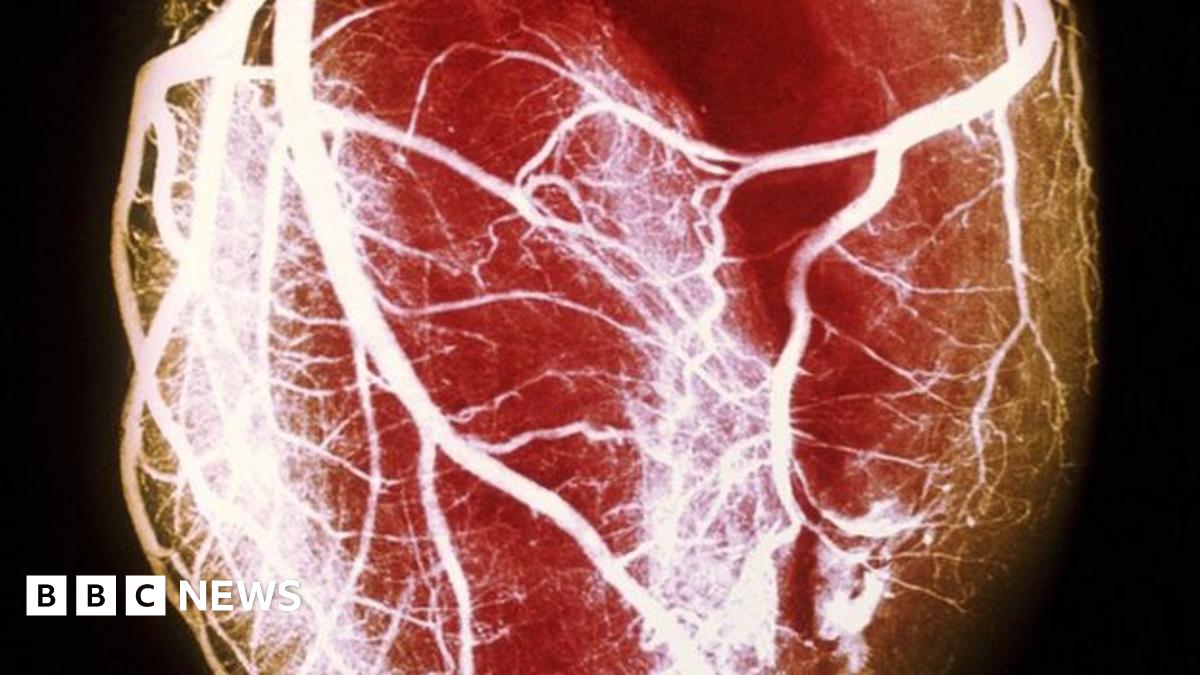 Doctors store 1,600 digital hearts for big data study - BBC News