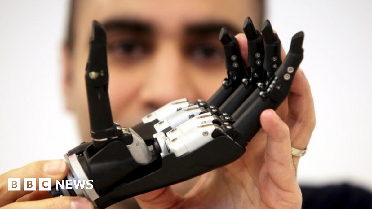 Newcastle University bionic limb project gets £1.4m boost - BBC News