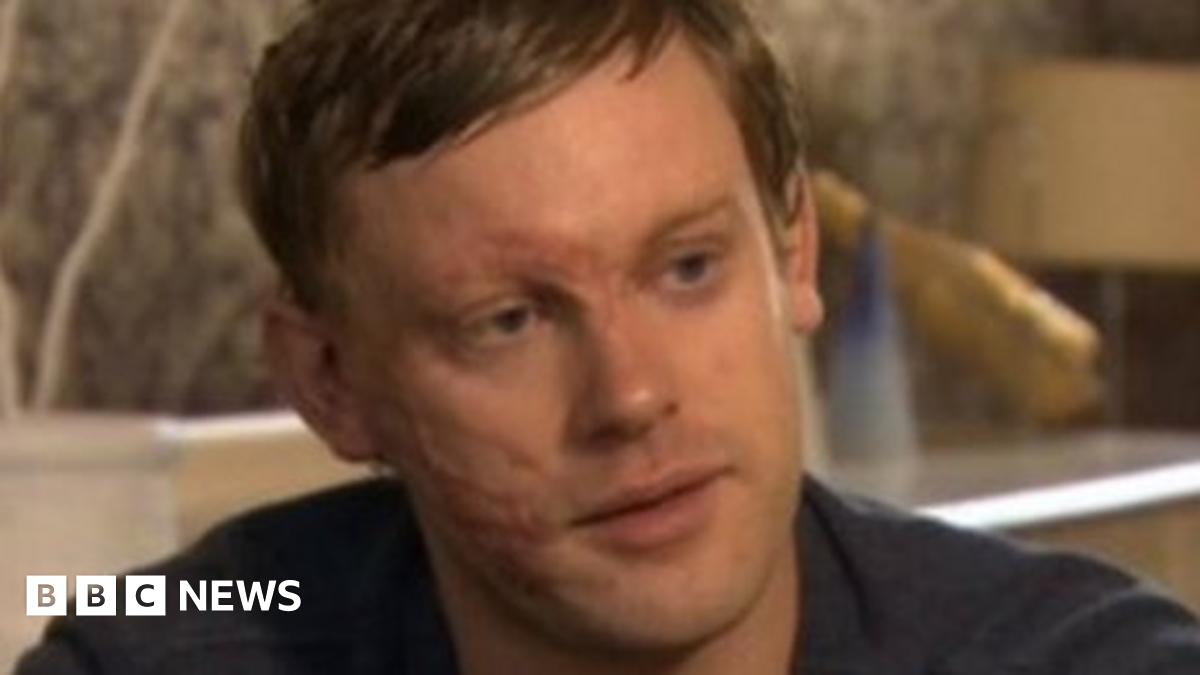 Man and woman charged over Essex acid attack - BBC News