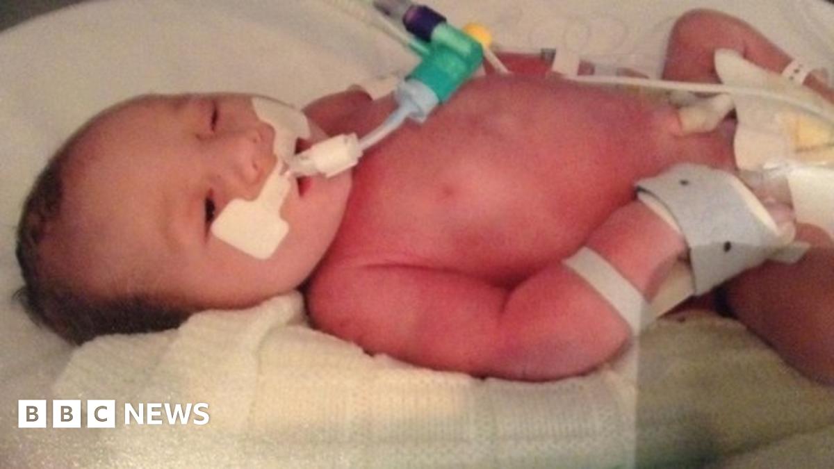 Is another NHS scandal brewing? - BBC News